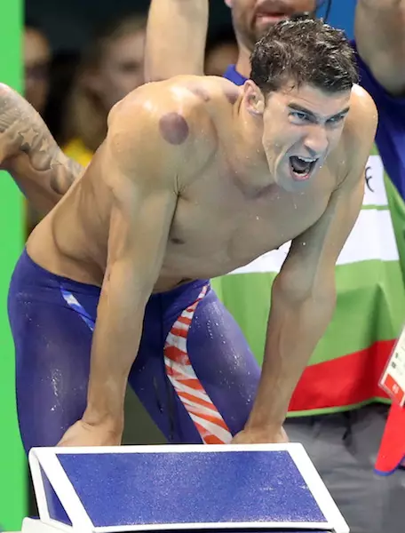 okirikiri ndị ahụ dị egwu na-acha odo odo na Michael Phelps sitere na Cupping