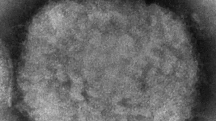एकल बाँदर पोक्स भाइरसको इलेक्ट्रोन माइक्रोस्कोप छवि।