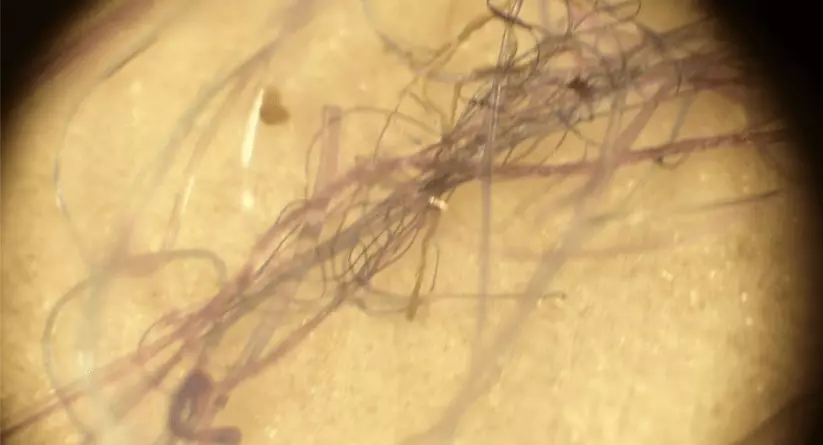 Inside Morgellons, Interneten gaixotasuna