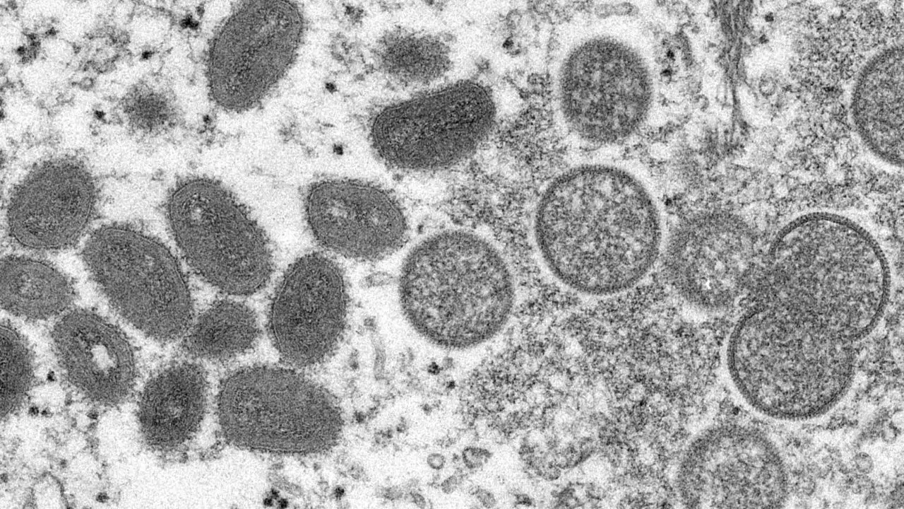 Monkeypox Salgınları: Neredeler ve Şimdiye Kadar Bildiklerimiz
