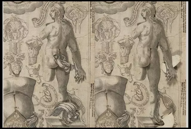 Columbia Ĵus Ciferecigis Plej Venditan Anatomian Flipbook El La 1600-aj jaroj