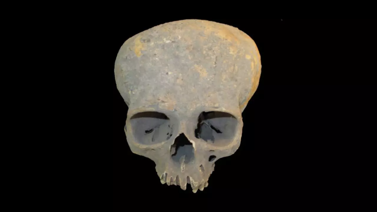 अन्तमा, मध्य युगबाट विचित्र मानव हड्डीहरूको डिजिटल पुस्तकालय
