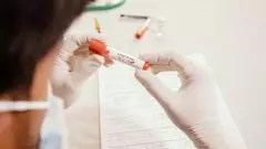 Как се тества коронавирус в Австралия