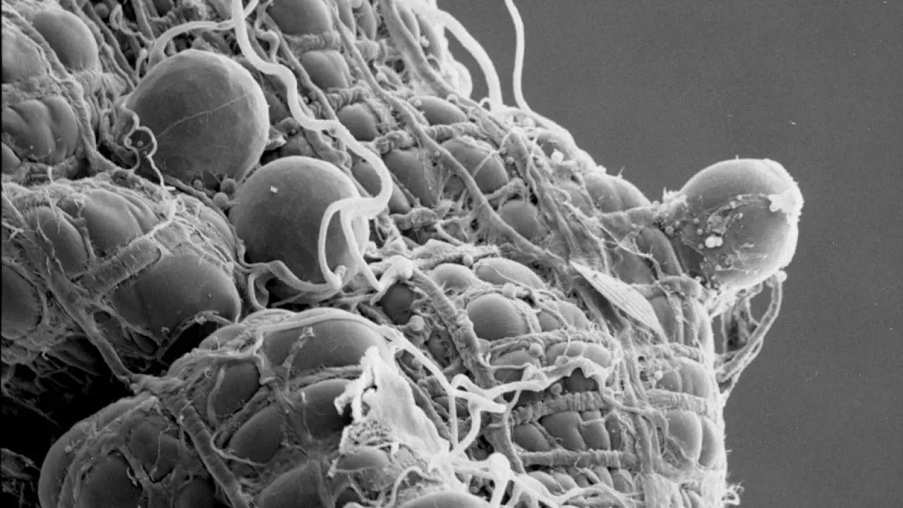 Vanjaar se Nobelprys in Geneeskunde gaan tot deurbrake in die stryd teen parasitiese siektes