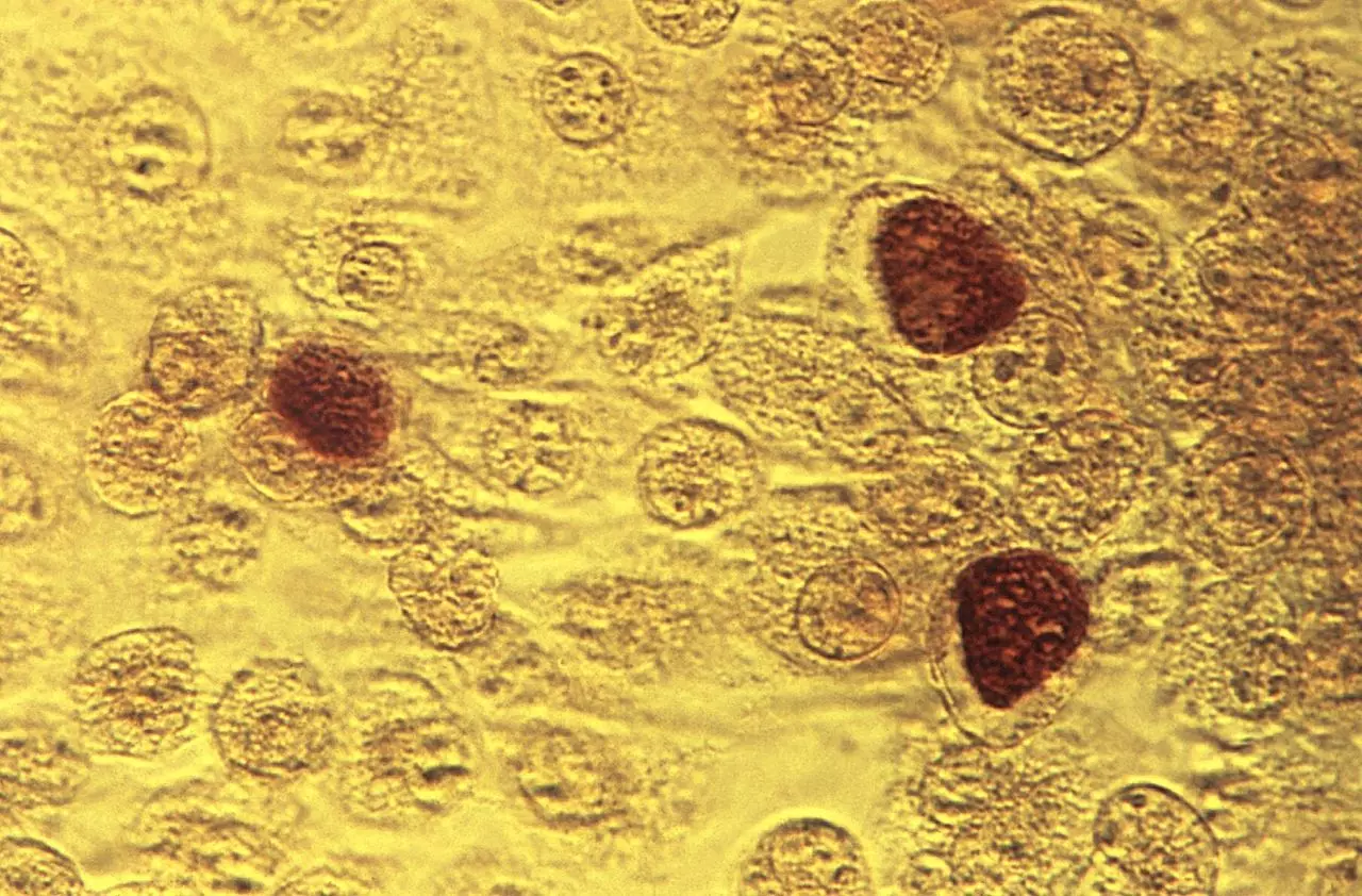 Бактерии Chlamydia имеют стадию жизни, когда они внедряются и живут внутри клеток-хозяев, что можно увидеть выше в более темных кружках. (Изображение: CDC/д-р Э. Арум; д-р Н. Джейкобс)