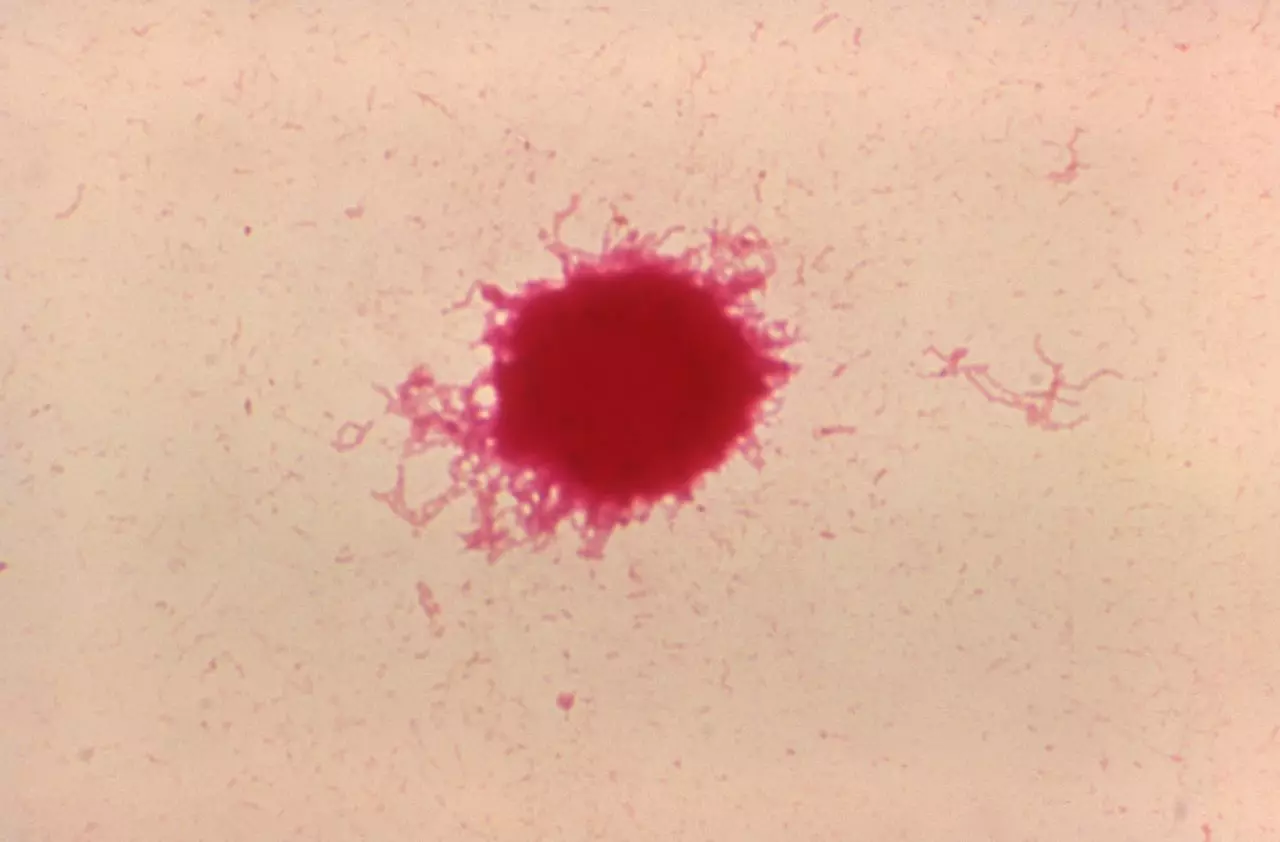 Un grupo de bacterias Haemophilus ducreyi encontrado en una muestra de sangre de conejo (Imagen: CDC/Dr. Greg Hammond)