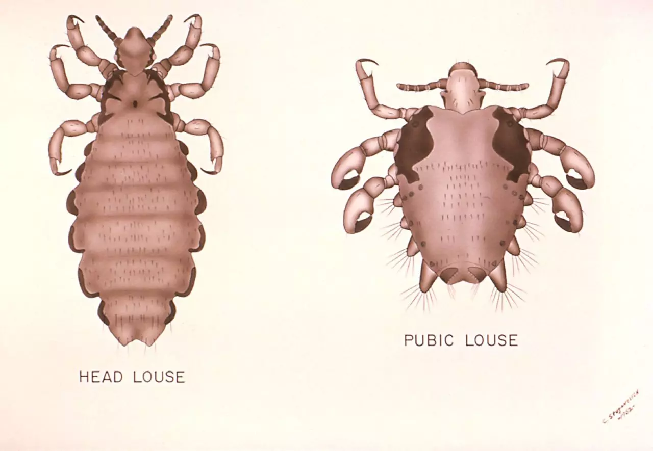 Una comparación entre los piojos de la cabeza y los piojos púbicos más parecidos a los cangrejos. (Ilustración: CDC)