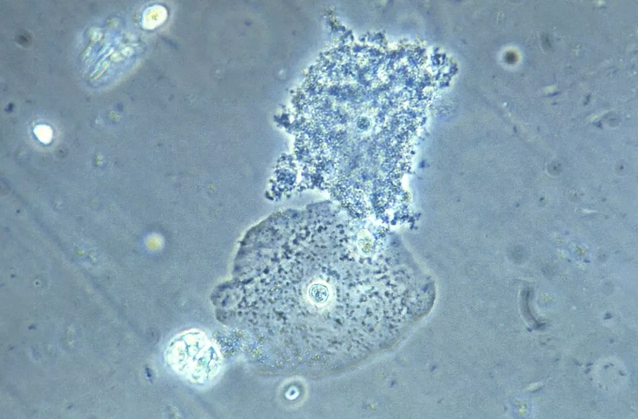 Eine mikroskopische Aufnahme von Vaginalzellen, die von jemandem gesammelt wurden, der Anzeichen einer bakteriellen Vaginose zeigt. (Bild: CDC/M. Rein)