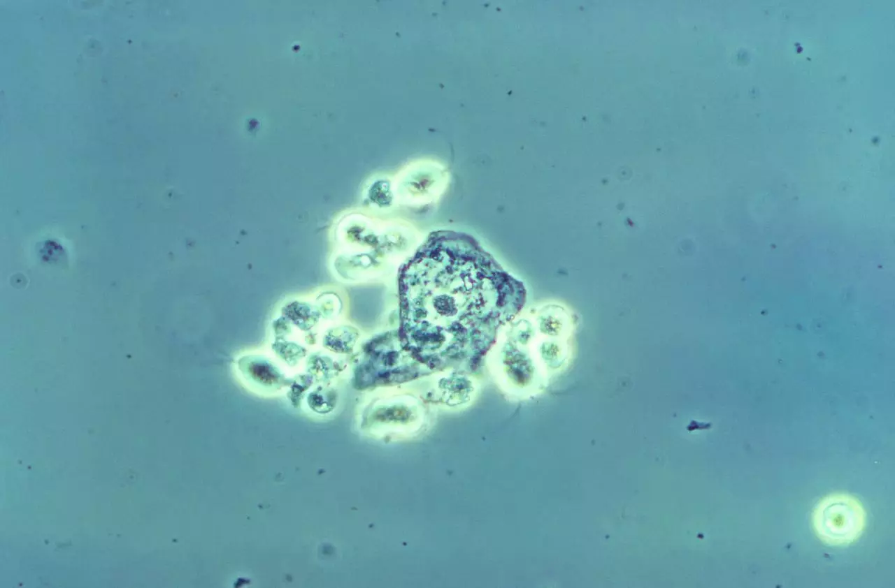 Trichomonas vaginalis parasitic protozoa အုပ်စုတစ်စု၊ မိန်းမကိုယ်မှဆင်းခြင်းမှစုဆောင်းသည်။ (ပုံ- CDC/Joe Miller)