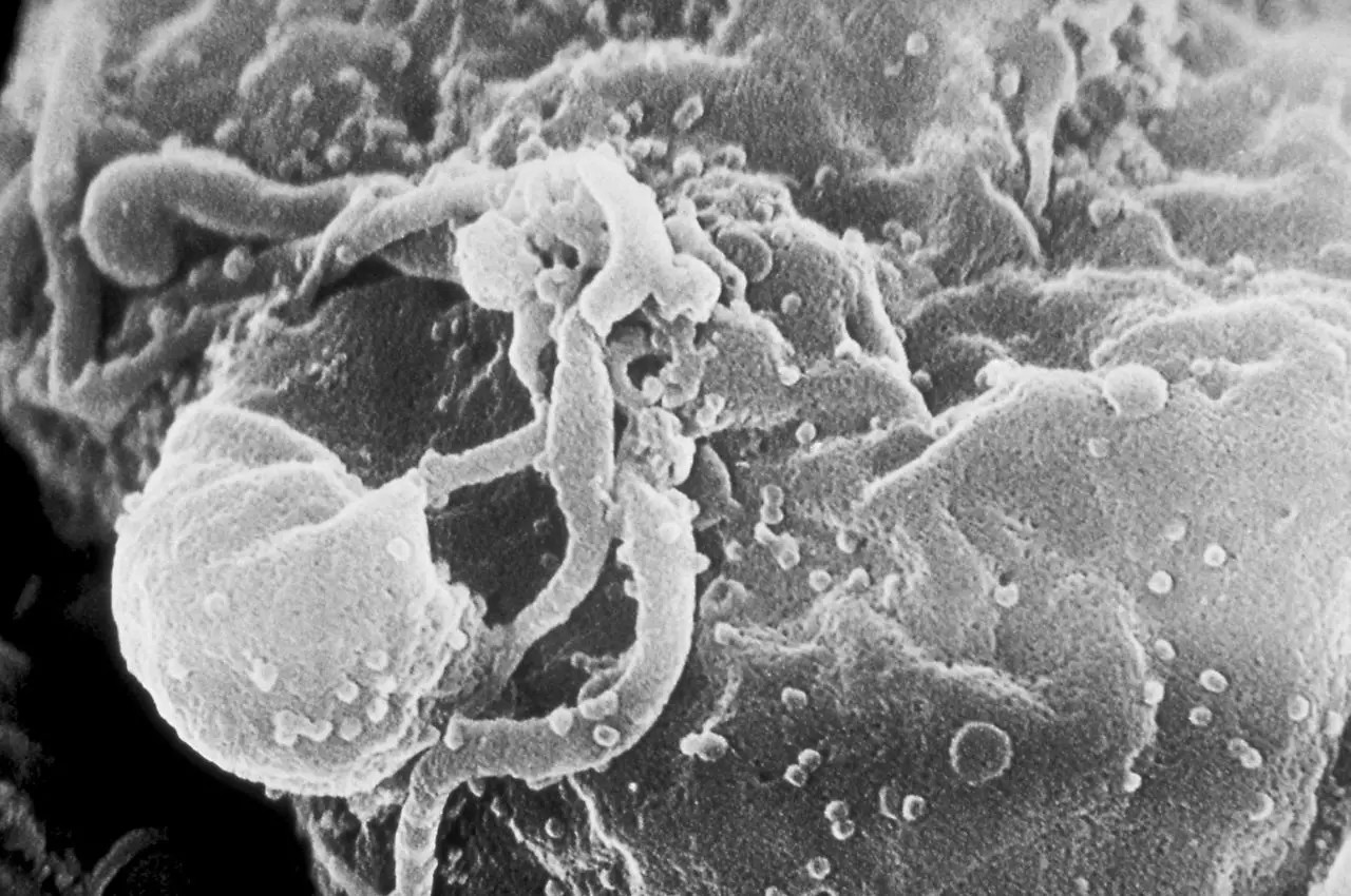 (एचआईवी-1) विषाणुओं की एक स्कैनिंग इलेक्ट्रॉन माइक्रोस्कोपिक (एसईएम) छवि, जिसे छोटे गोल धक्कों के रूप में देखा जाता है। (छवि: सीडीसी / सी गोल्डस्मिथ)