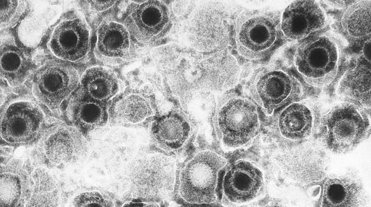 Una imagen de microscopía electrónica de transmisión (TEM) teñida negativamente de los virus del herpes simple.