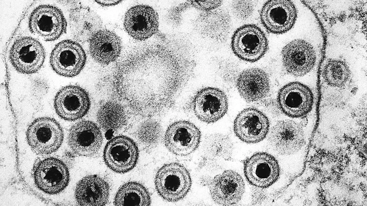 Transmisní elektronový mikroskopický obraz (TEM) mnoha virů herpes simplex. (Obrázek: CDC/Dr. Fred Murphy, Sylvia Whitfield)