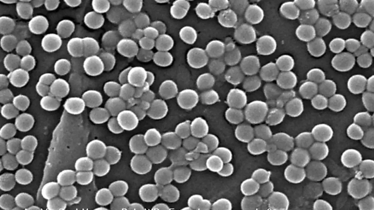 Mabakiteriya osamva methicillin a Staphylococcus aureus (MRSA) pansi pa microscope ya elekitironi. (Chithunzi: Smith Collection/Gado/, Getty Images)