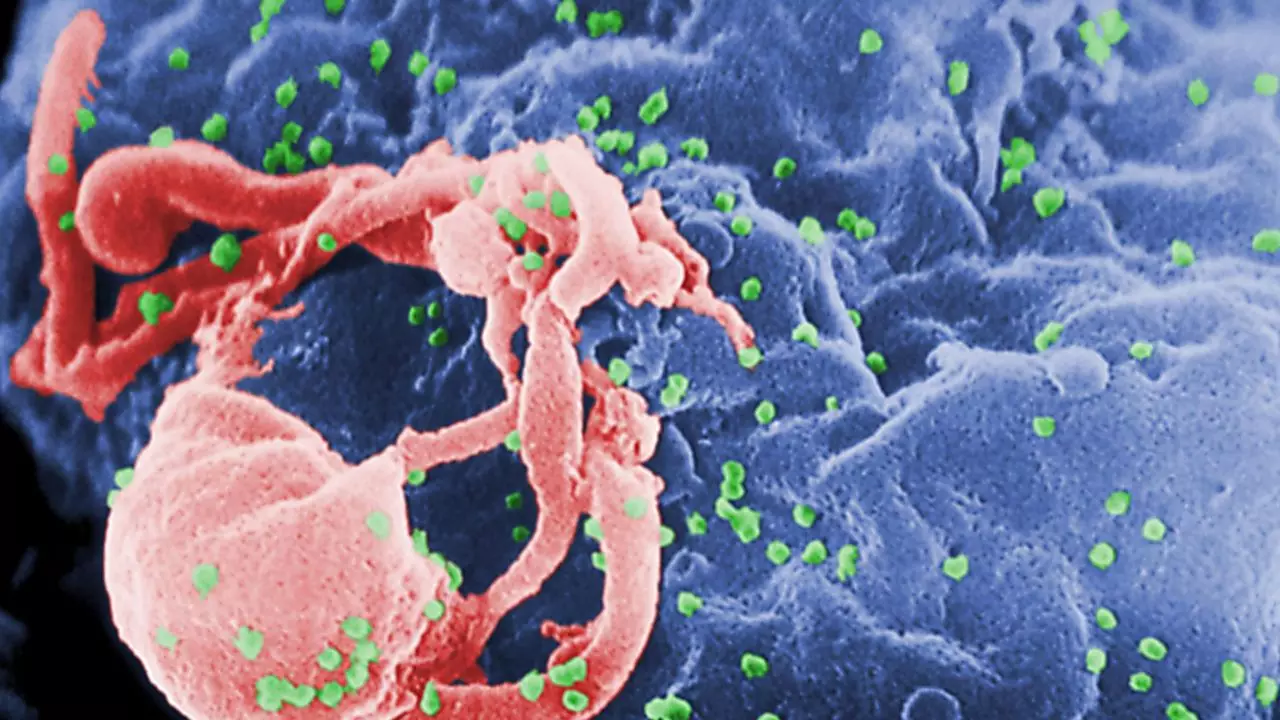 I-electron micrograph (SEM) ethwebulayo yama-virion e-HIV-1 njengamaqhubu ayindilinga aluhlaza (Isithombe: Smith Collection/Gado, (Getty Images))