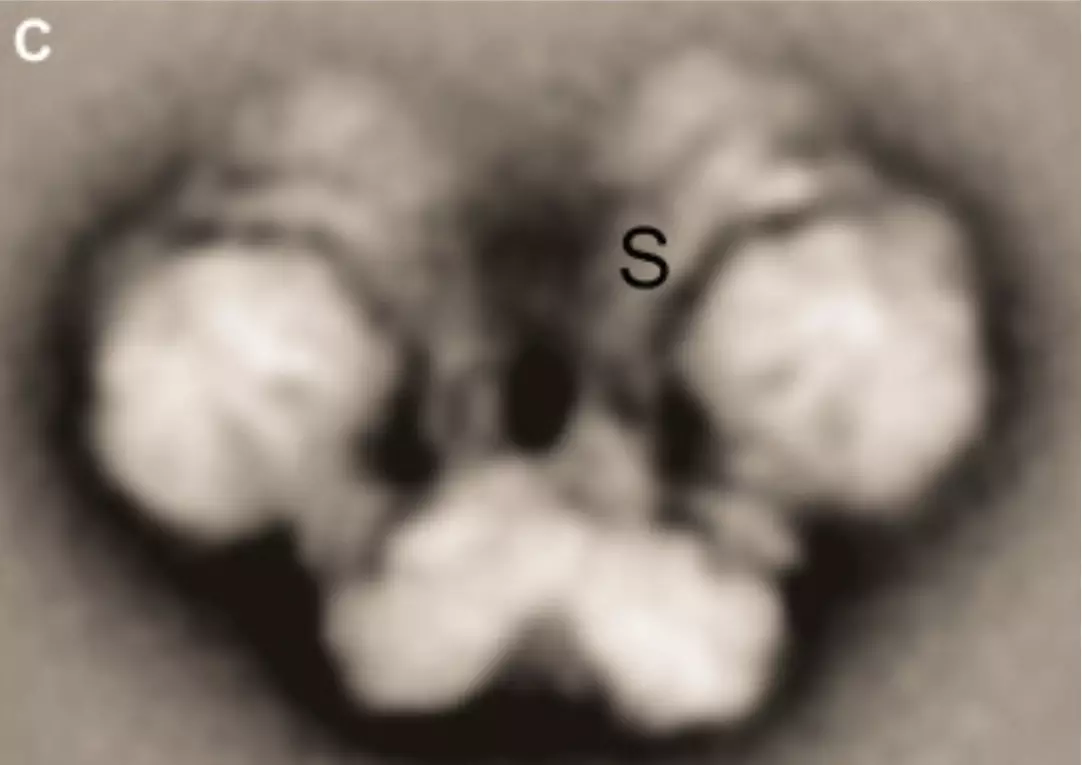 Aqui estão algumas imagens incríveis possibilitadas pelo Prêmio Nobel de Química deste ano