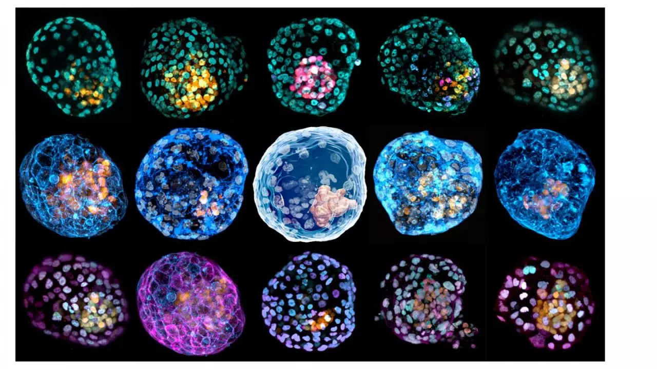 iBlastoids teñidos, las estructuras sintéticas que imitan a los blastocistos humanos. (Imagen: Universidad de Monash)