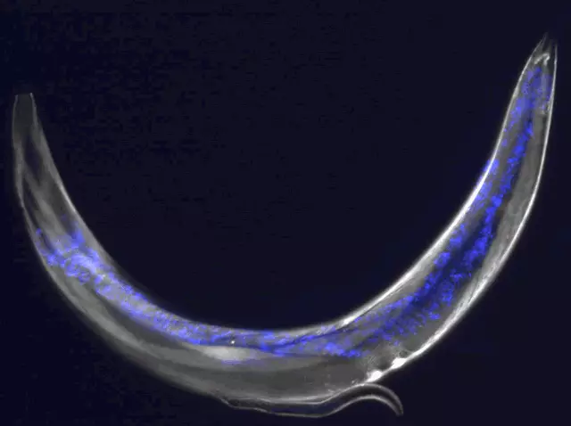 Die erste Beobachtung der Totenstarre bei Würmern könnte uns helfen, den Tod durch das Alter zu verstehen