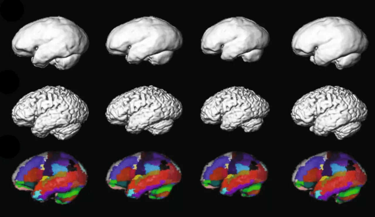 Ar neandertaliečiai išnyko dėl savo smegenų dydžio?