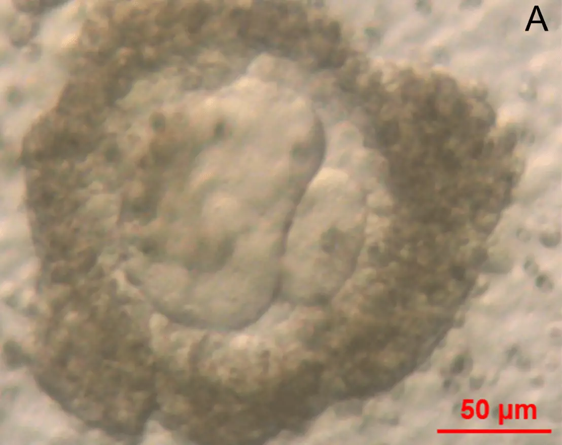 Forsiktig optimisme når forskere dyrker menneskelige egg fra umodne celler i laboratoriet