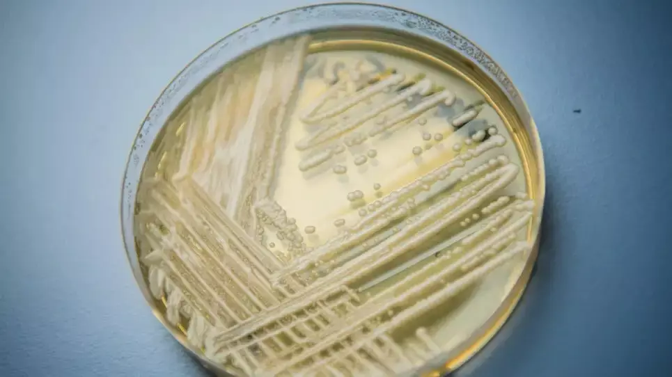 Candida auris en una placa de Petri.