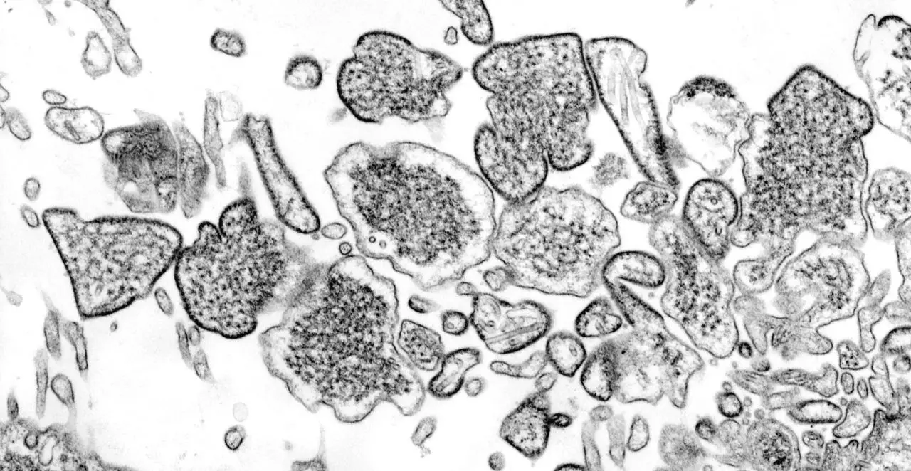 Delci virusa Nipah, ki so bili izolirani iz pacientove cerebrospinalne tekočine. (Slika: Cynthia Goldsmith/CDC)