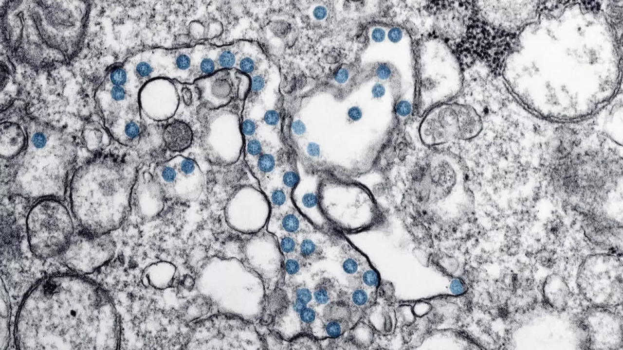 Wiruslar diriligiň nämäni aňladýandygyny sorag astyna alýar