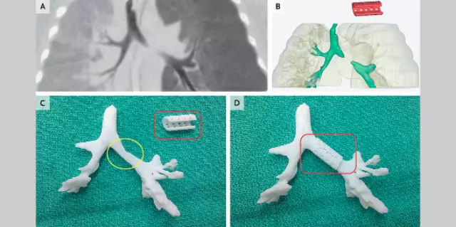 Objetos que não podiam ser feitos antes da existência das impressoras 3D