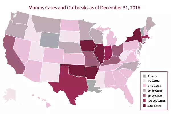 Nisy valan'aretina Freak Mumps namely ny fanjakan'i Washington