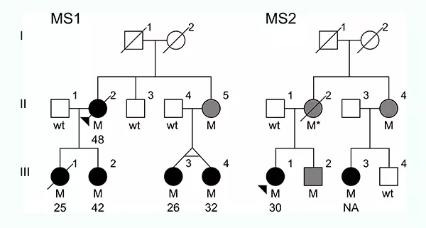 Mutația genetică rară poate explica unele forme de scleroză multiplă